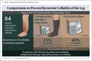 » Compression Therapy for Cellulitis Prevention - Lipedema