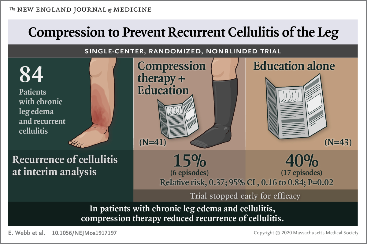 Compression Therapy For Cellulitis Prevention Lipedema Compression Therapy For Cellulitis Prevention Lipedema