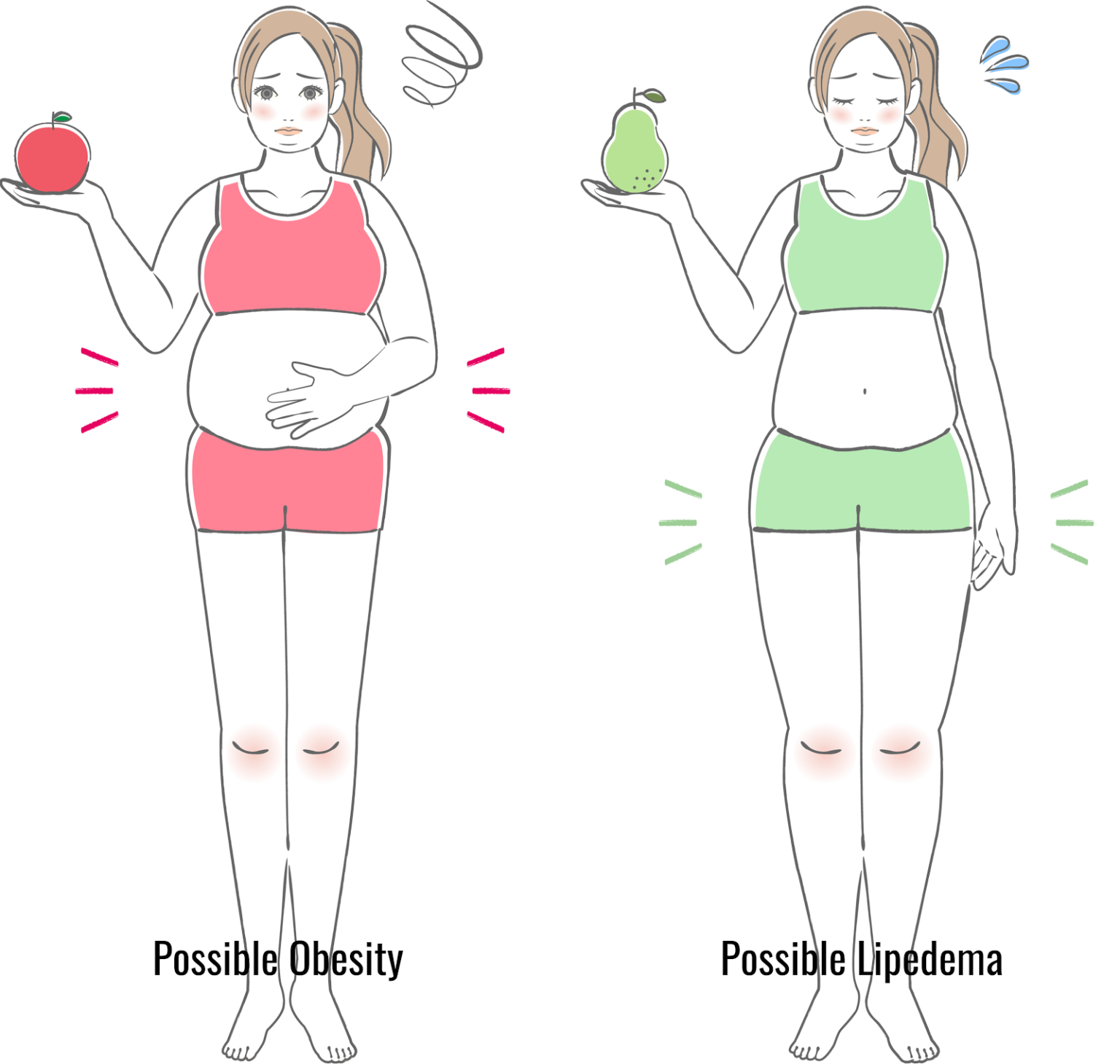 Lipedema Diagnosis, Obesity & BMI | Lipedema.net
