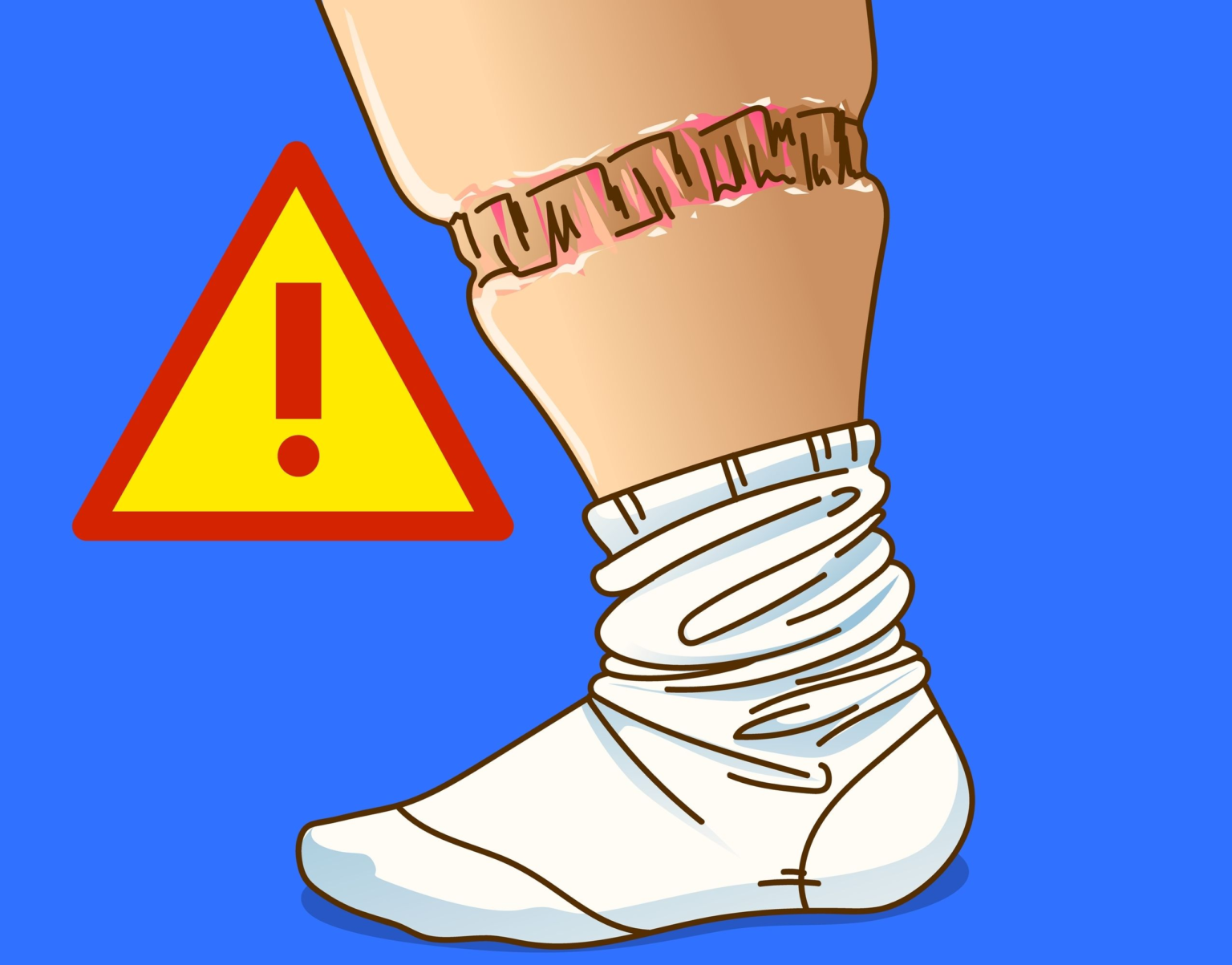 » Compression 101: Lipedema Compression Garments - Lipedema