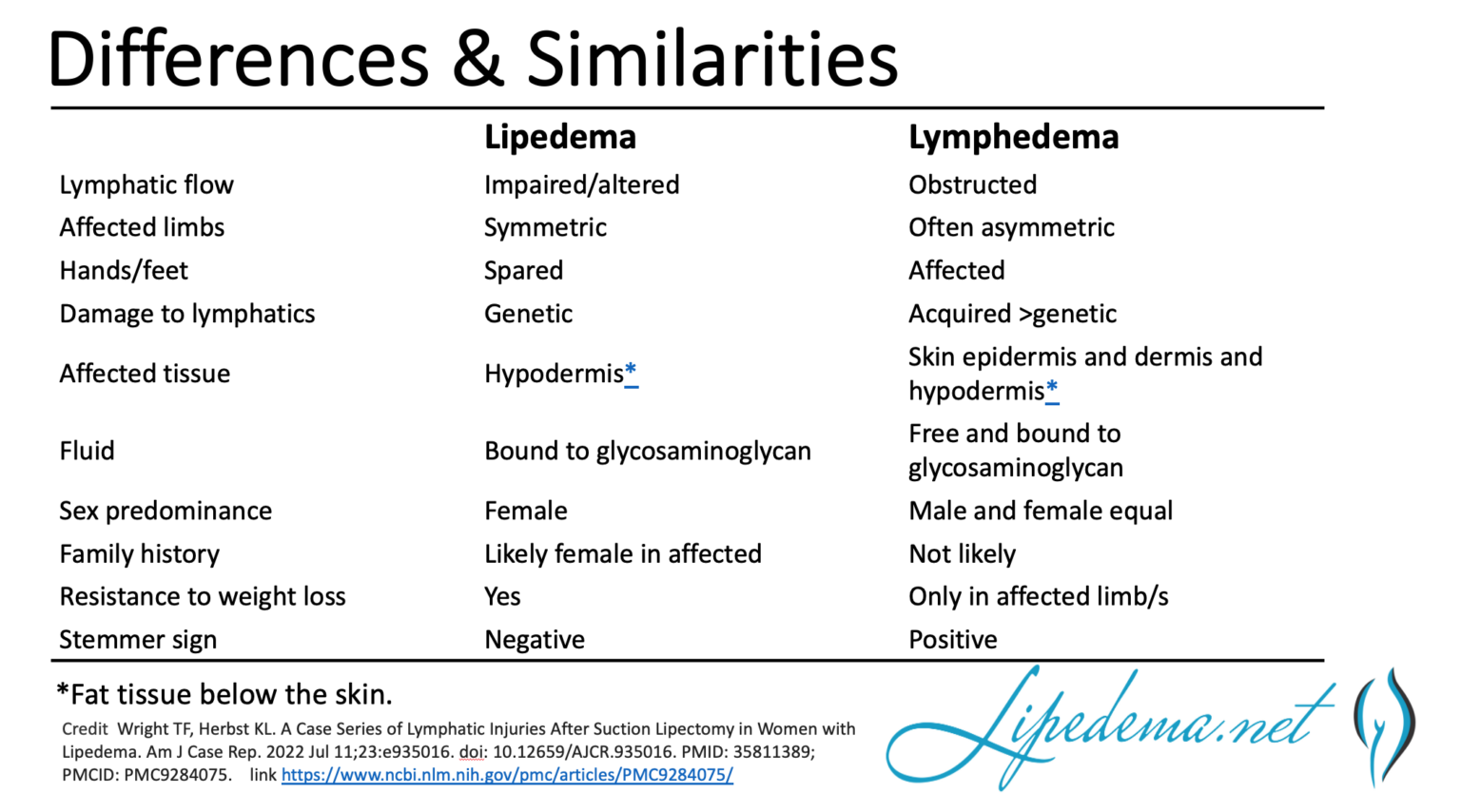 » Lymphedema vs. Lipedema - Lipedema