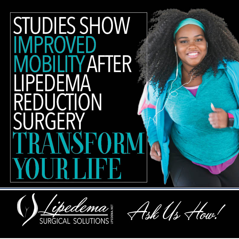 Improved Mobility with Lipedema Reduction Surgery | Lipedema